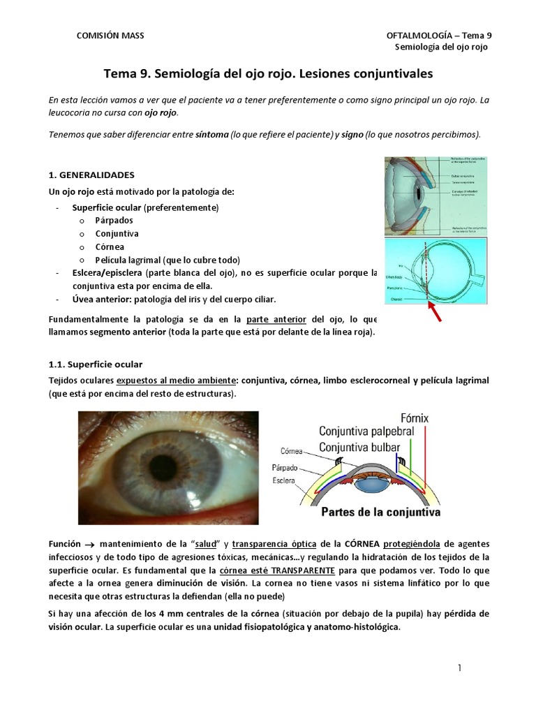 Semiología del ojo rojo: identificando las causas de la hiperemia ...