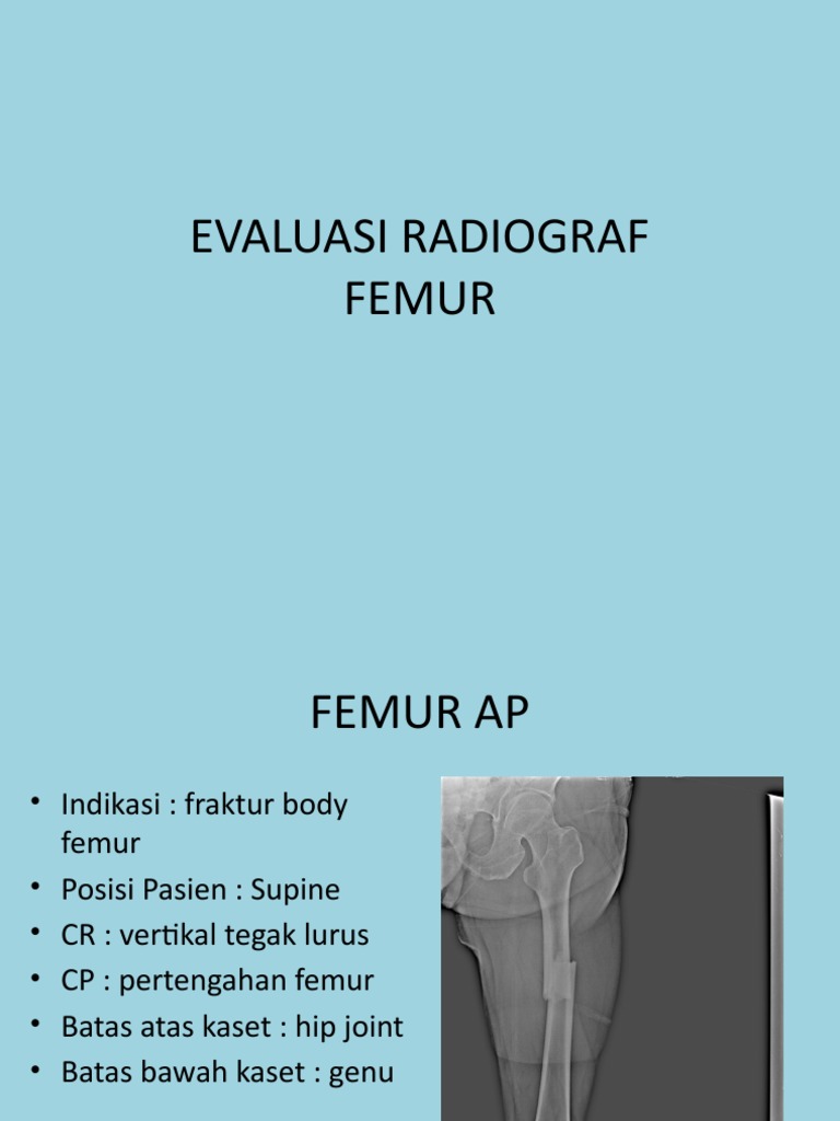 Evaluasi Radiograf Femur | PDF | Sains & Matematika