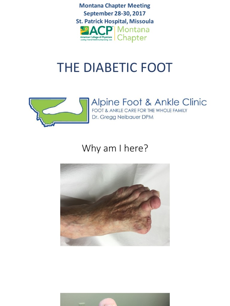 Diabetic Foot | PDF | Diabetes | Physical Examination