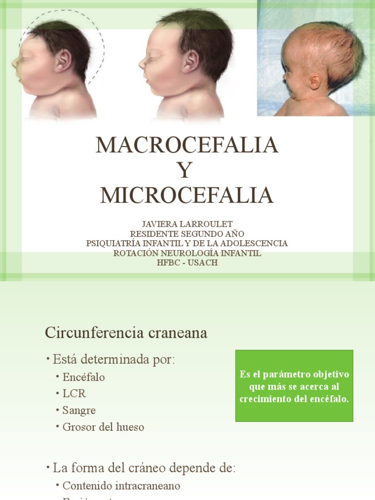 Macrocefalia y Microcefalia: Diagnóstico y Causas | PDF | Cráneo ...