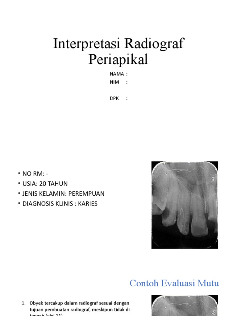 CONTOH Interpretasi Radiograf Periapikal | PDF
