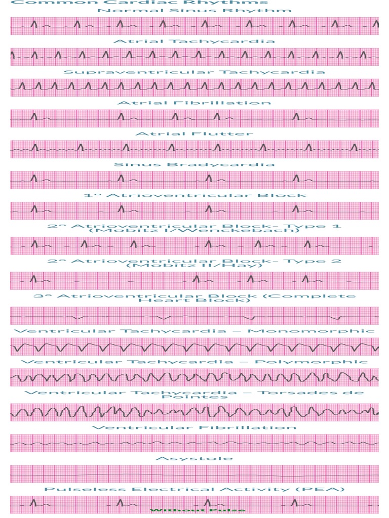 ACLS Algorithms 2020 (Advanced Cardiac Life Support) | PDF ...