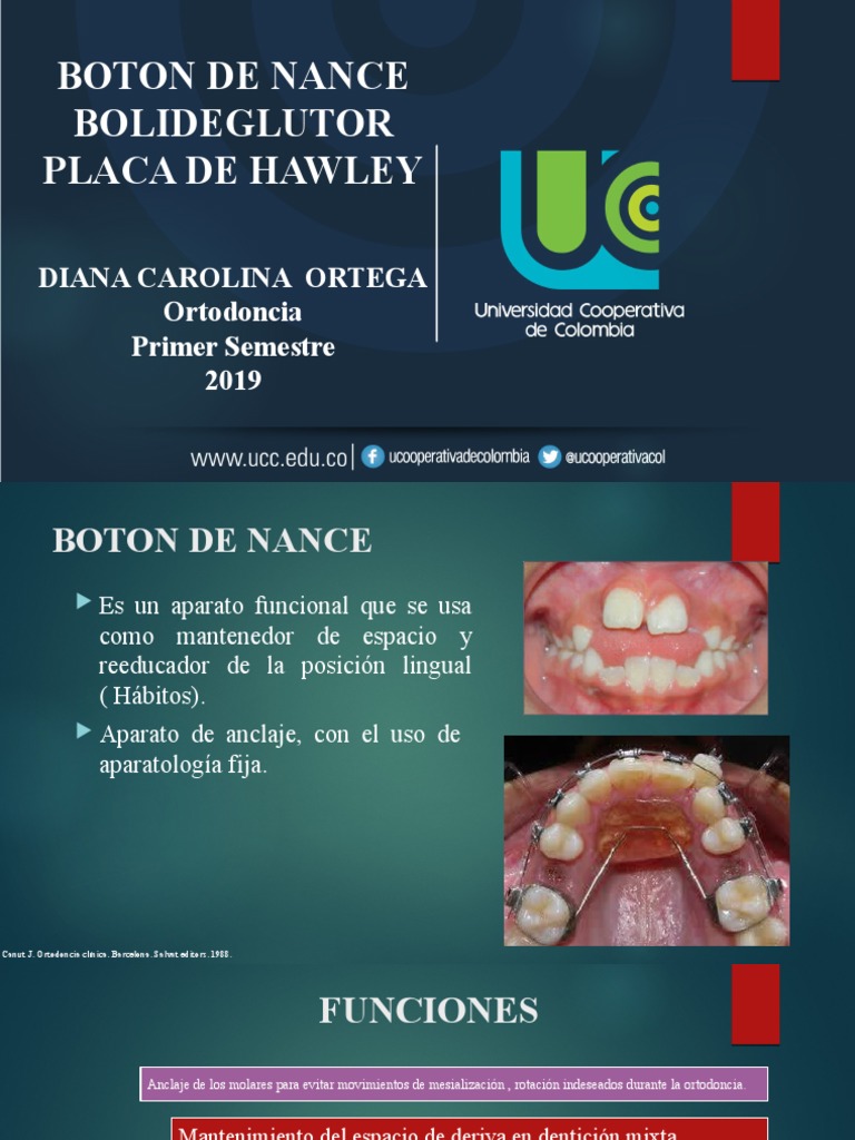 Seminario Boton de Nance, Bolideglutor y Hawley | PDF | Ortodoncia | Cara