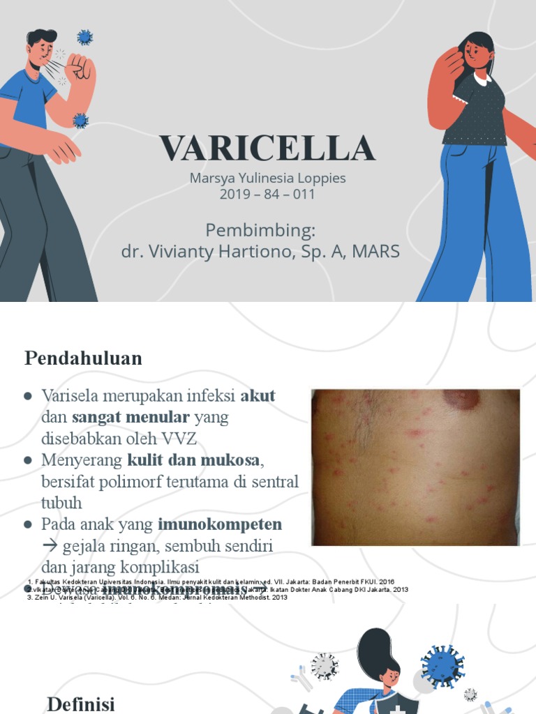 Varicella | PDF