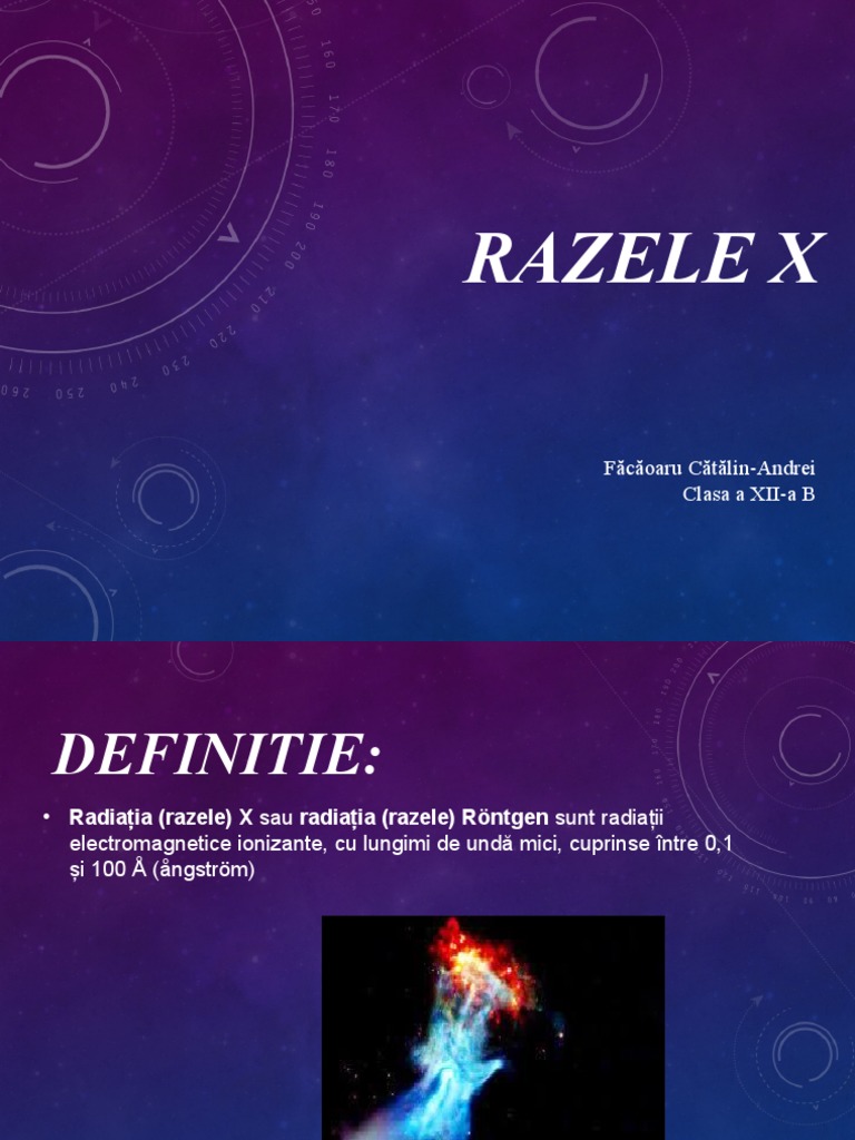 Raze X - Proiect Fizica | PDF
