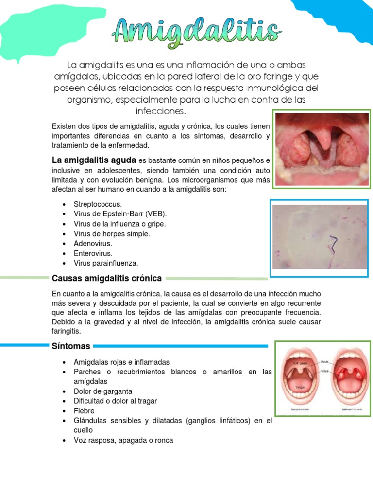 Amigdalitis | PDF