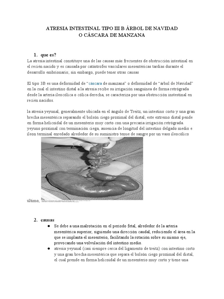 Atresia Intestinal Tipo III B: Causas y Manejo | PDF | Tracto ...