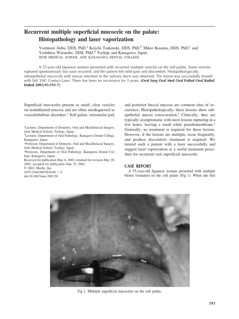 Recurrent Multiple Superficial Mucocele On The Palate: Histopathology ...