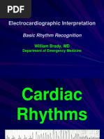 EKG Pocket Guide | PDF | Cardiac Electrophysiology | Electrocardiography