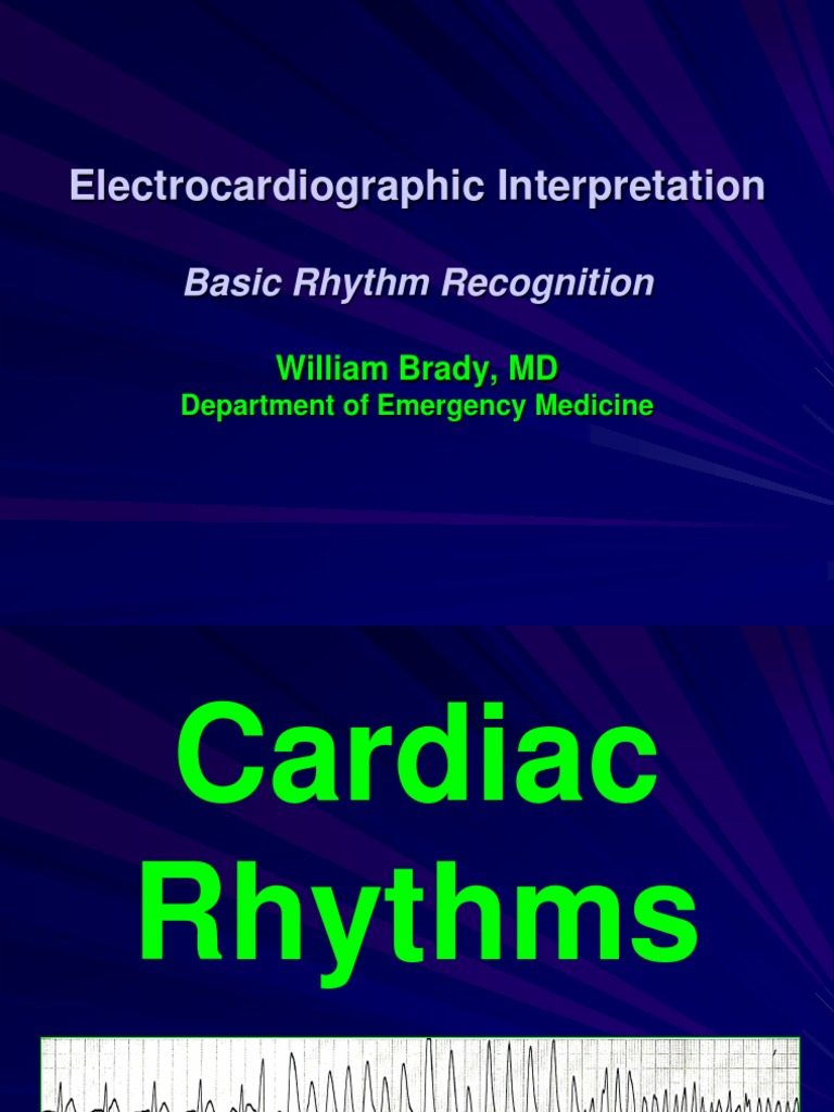 Introduction To ECG Rhythms | PDF | Artificial Cardiac Pacemaker ...