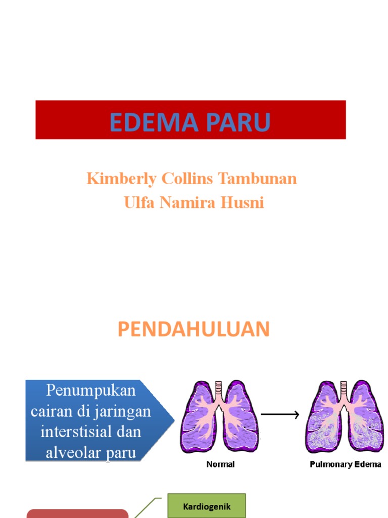 Edema Paru | PDF