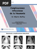 Punto de McBurney | PDF | Abdomen | Síntomas y signos