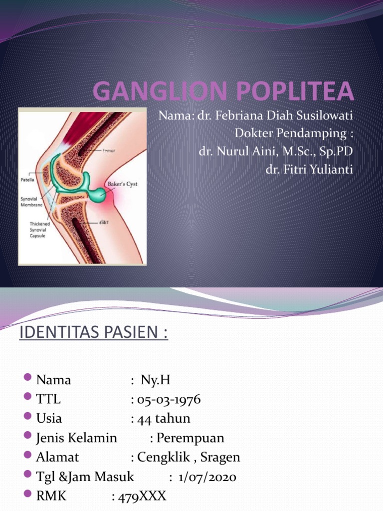 Ganglion Poplitea | PDF