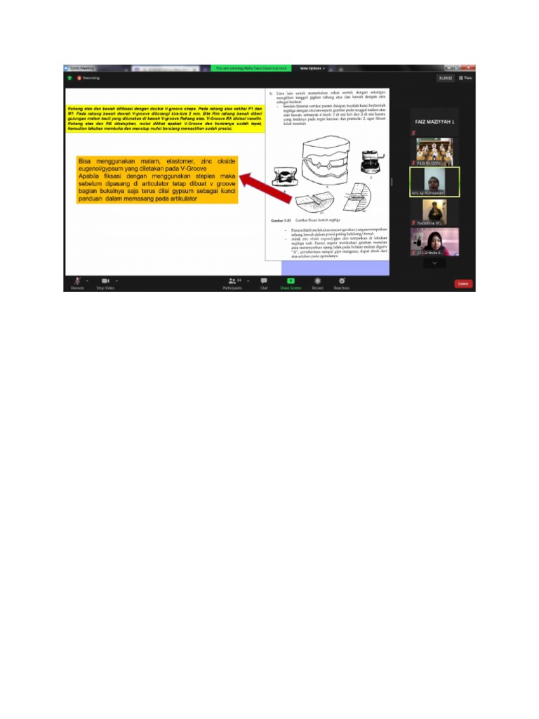Border Moulding, Pencetakan Fisiologis & Pembuatan Model Kerja ...