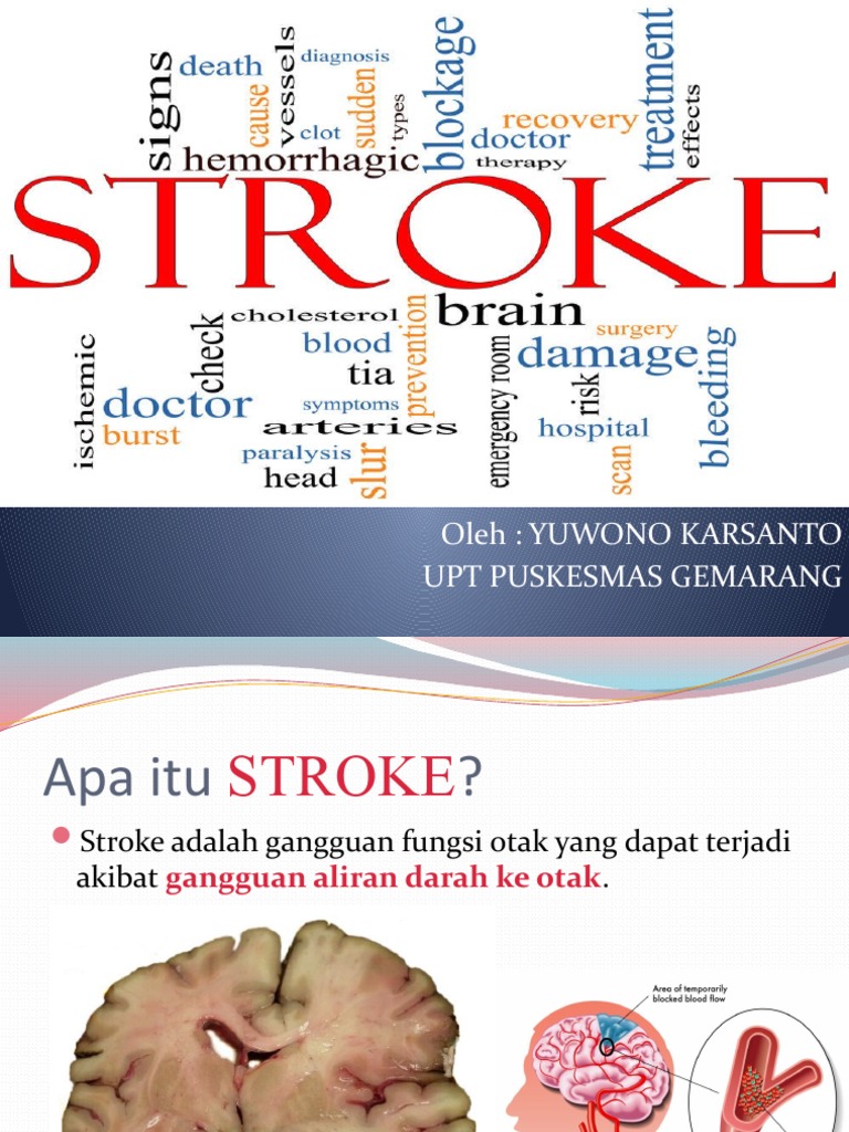 Stroke | PDF