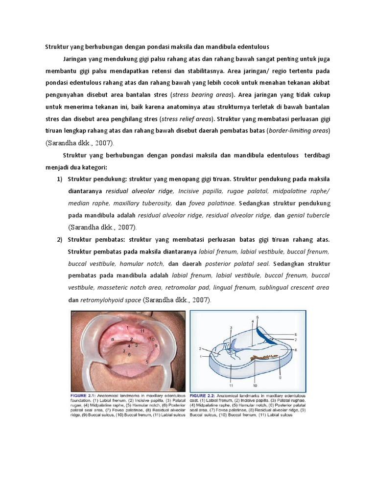 Struktur Pendukung Edentulous Maksila-Mandibula | PDF