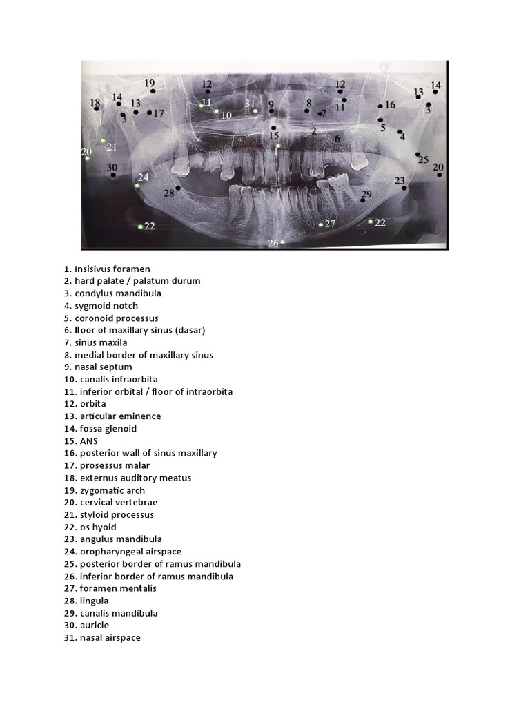 Panoramic Anatomy Landmarks Overview | PDF | Science & Mathematics