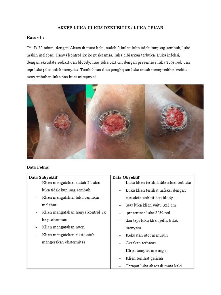 ASKEP LUKA ULKUS DEKUBITUS (Meilia Ayu Utami 3A) | PDF