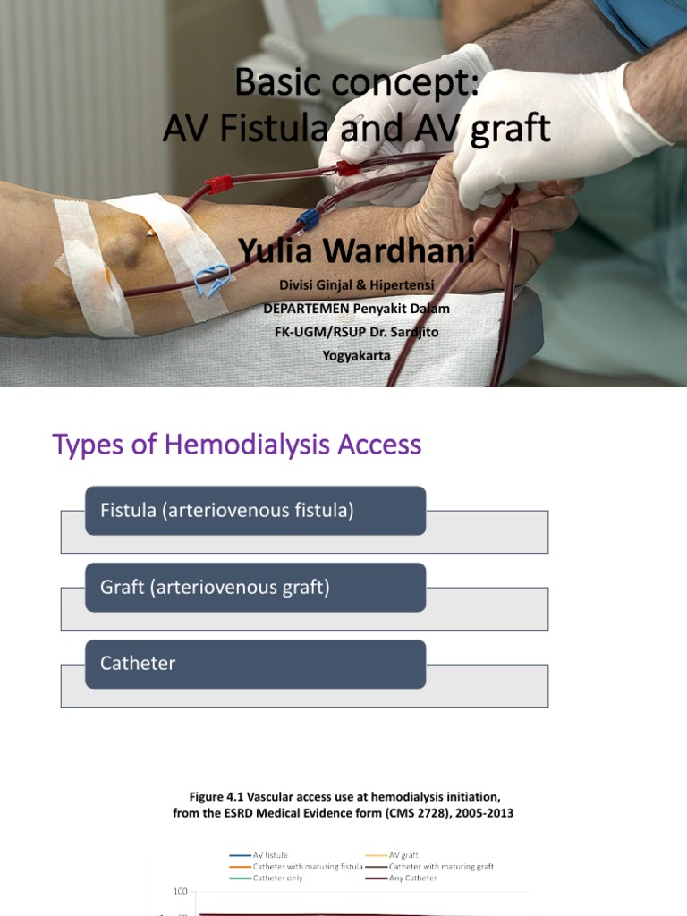 AV Fistula vs. Graft for Dialysis Access | PDF | Hemodialysis | Medicine
