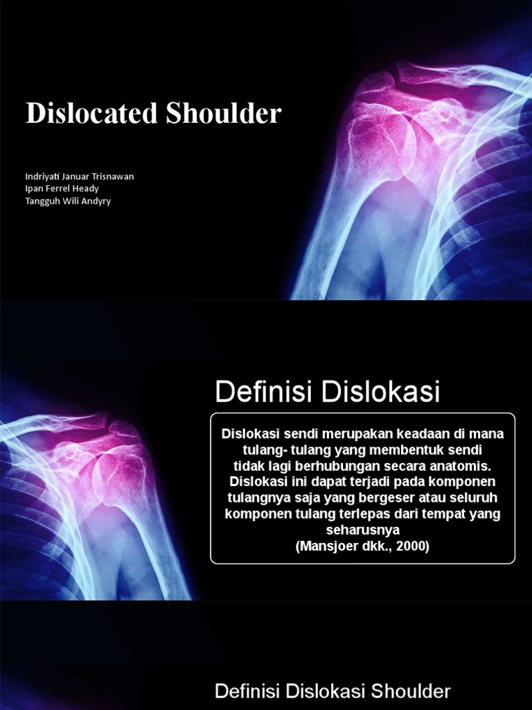 Dislokasi Shoulder | PDF