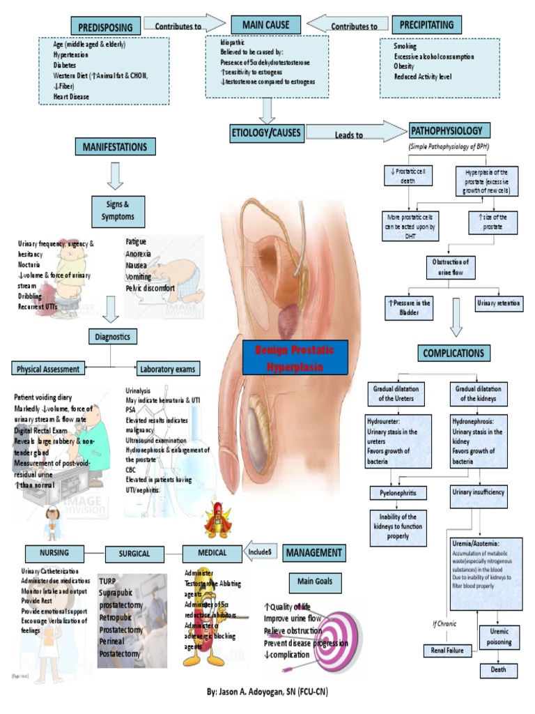 Benign Prostatic Hyperplasia Concept Map | Download Free PDF | Rtt | Urology