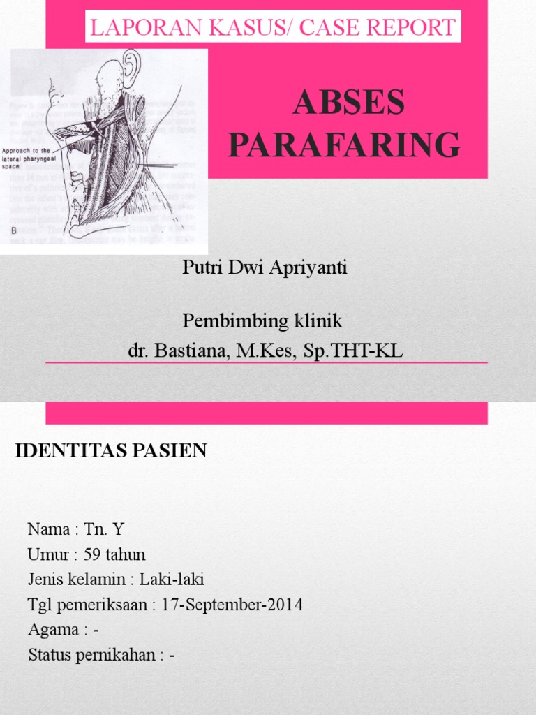New Abses Parafaring | PDF
