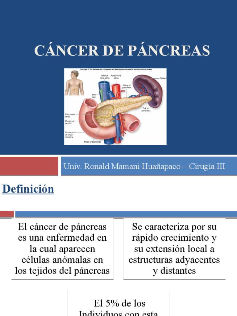 Ca de Pancreas | PDF | Cáncer de páncreas | Páncreas