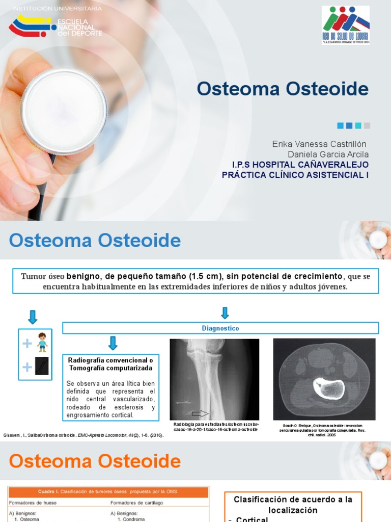 Osteoma Osteoide FINAL | PDF | Rodilla | Tobillo