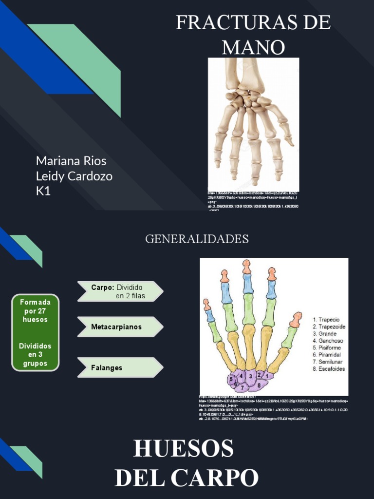 Fracturas de Mano: Tipos y Tratamientos | PDF | Mano | Articulaciones