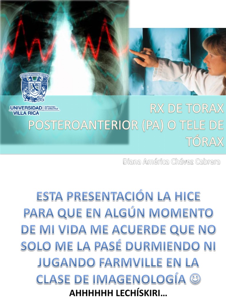 RX de Torax1 | PDF | Tórax | Tórax (anatomía humana)