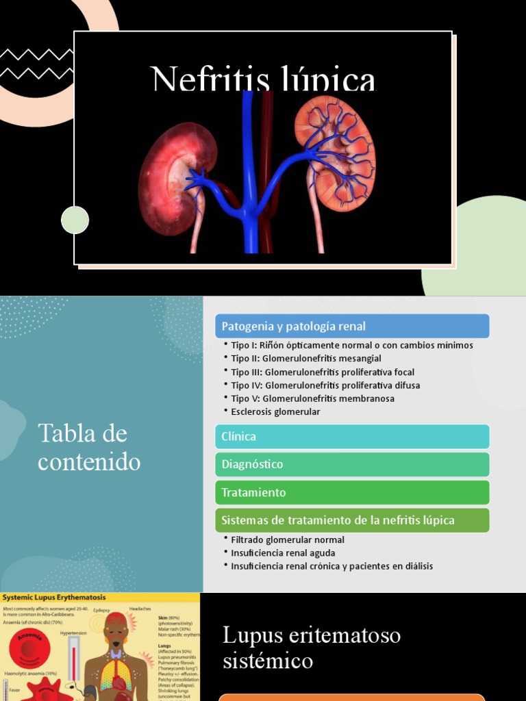 Nefritis Lúpica | PDF | Especialidades Medicas | Enfermedades y trastornos