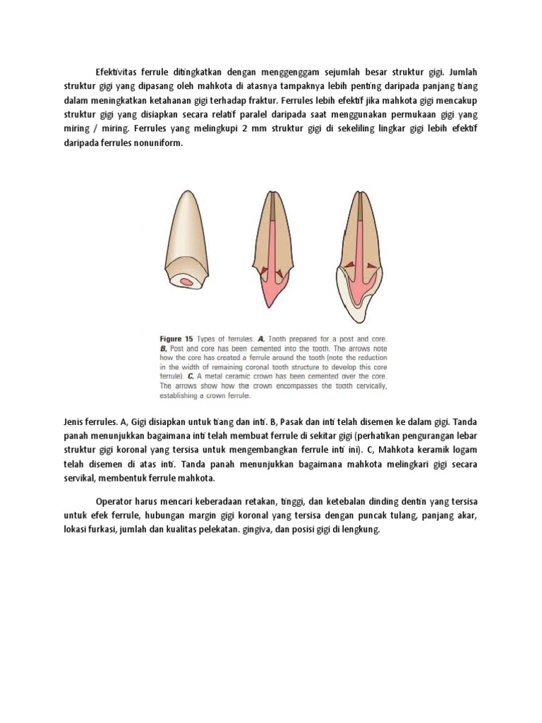 Ferrule Effect | PDF