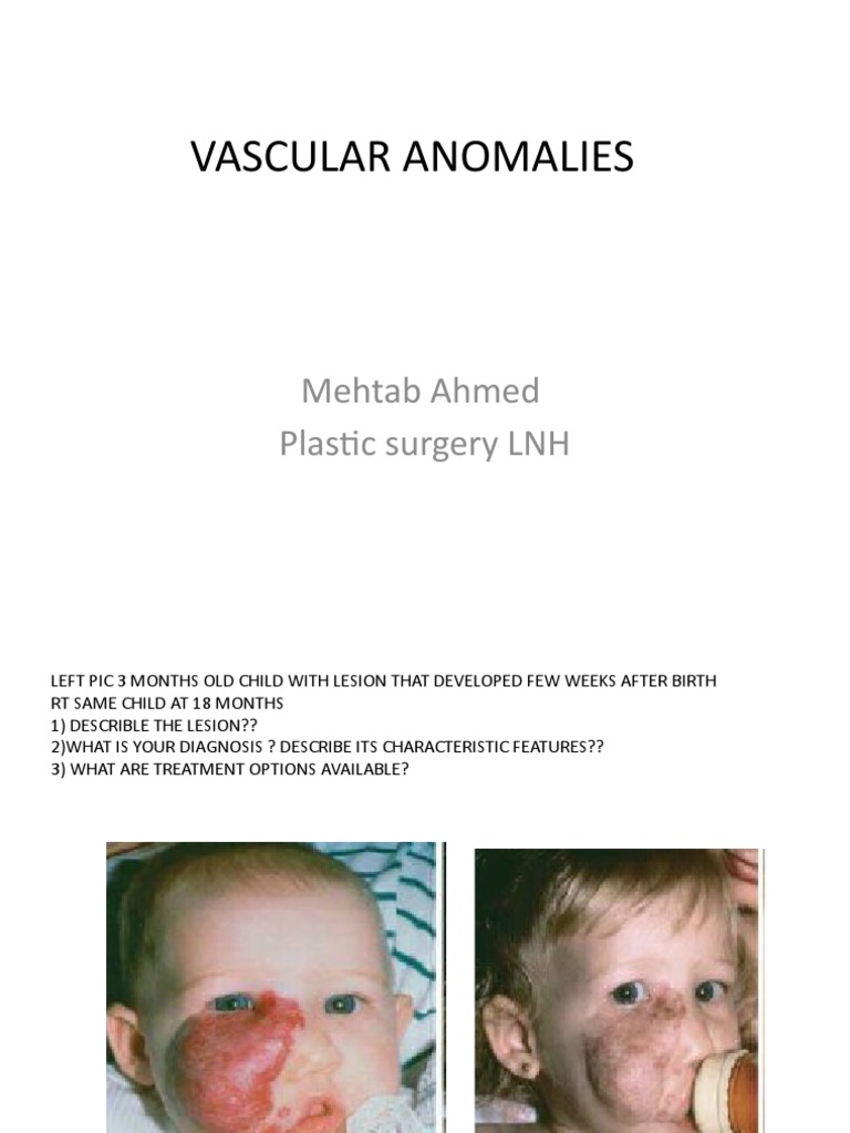 Classification, Diagnosis and Management of Vascular Anomalies in ...