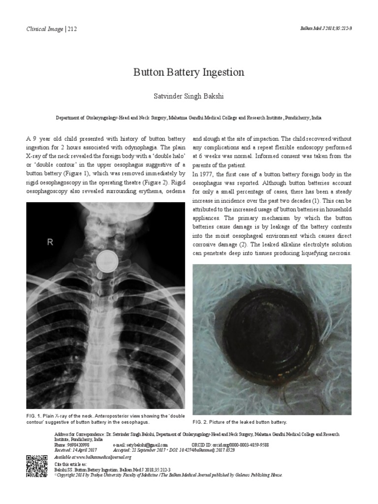 Button Battery Ingestion | PDF | Esophagus | Medical Specialties