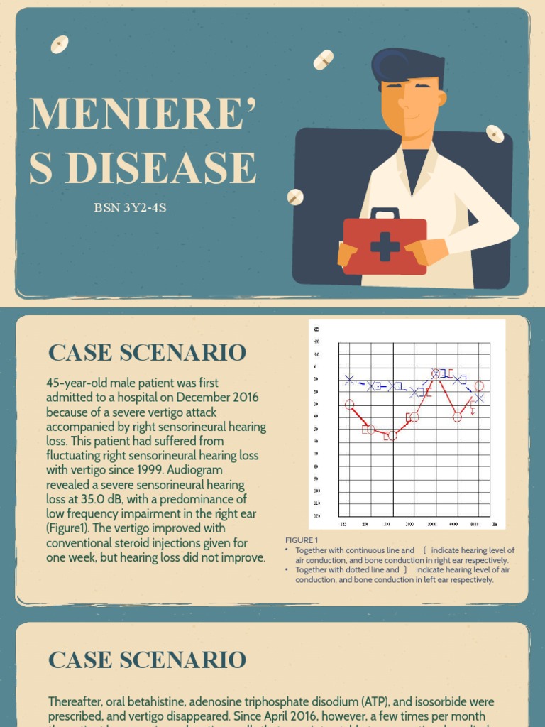 Menieres Disease 1 | PDF | Intravenous Therapy | Tinnitus