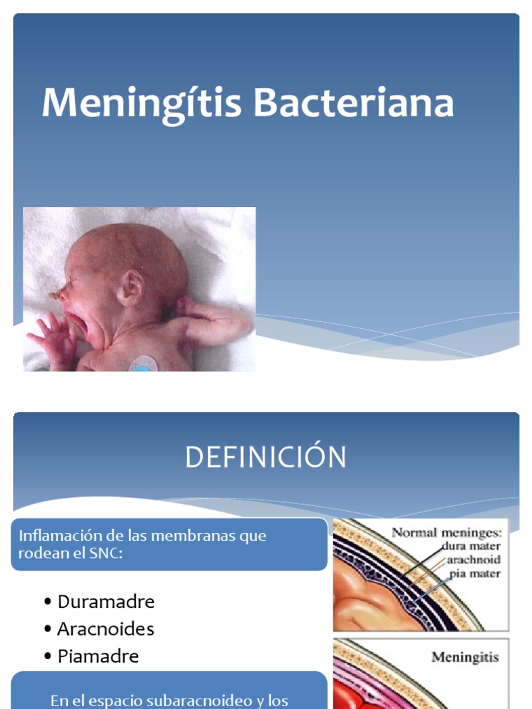 Meningitis Bacteriana. | PDF | Meningitis | Epidemiología