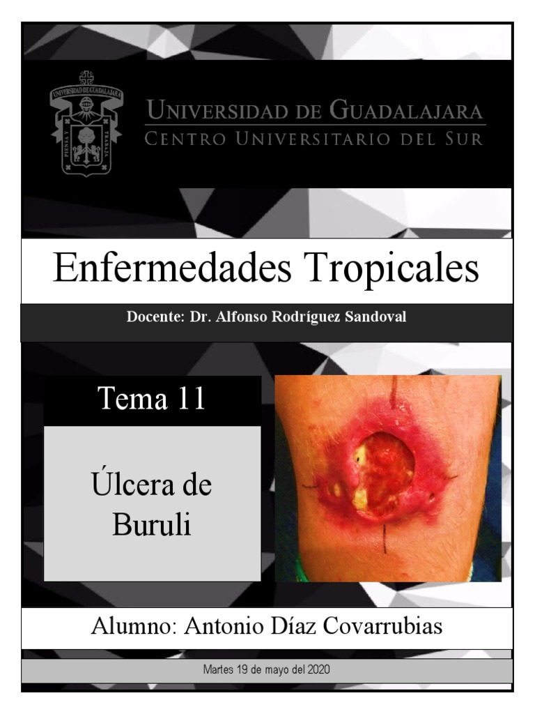 Úlcera de Buruli: Causas y Tratamiento | PDF | Ciencias de la Salud ...