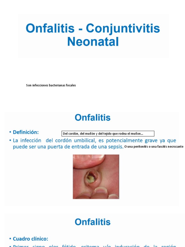 Onfalitis y Conjuntivitis Neonatal | PDF | Inmunología | Microbiología