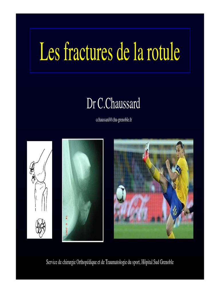 Fractures de la Rotule : Classification et Traitement | PDF | Médecine ...