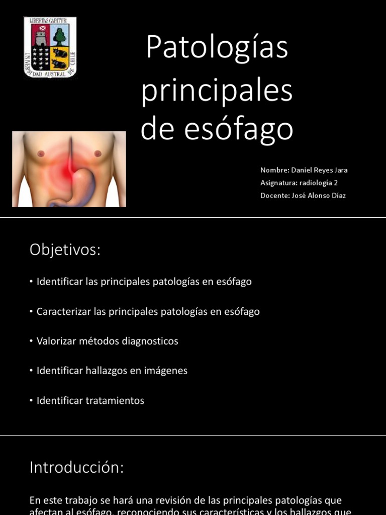 Patologia de Esofago | PDF | La enfermedad por reflujo gastroesofágico ...