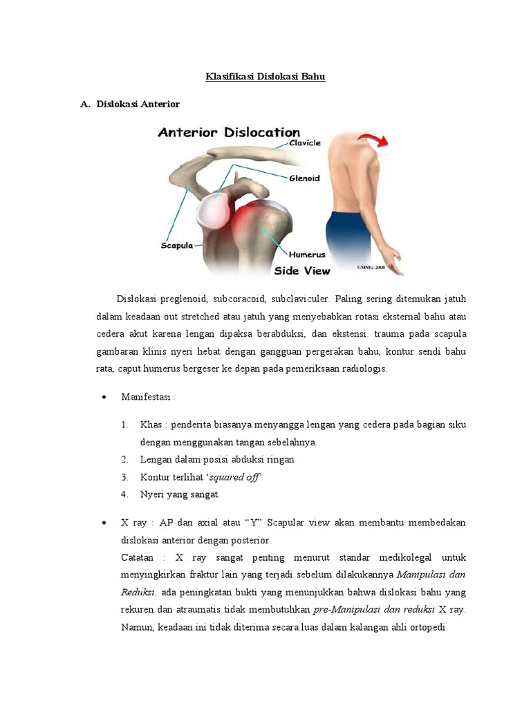 Klasifikasi Dislokasi Bahu LI 6 | PDF