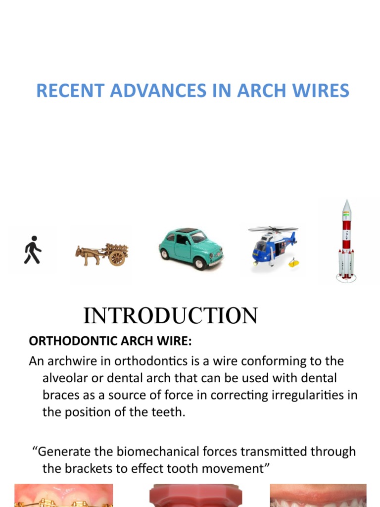 Newer Orthodontic Arch Wires | PDF | Composite Material | Wire