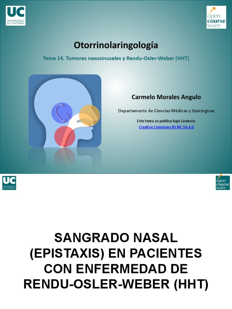 Tumores Nasales | PDF | Neoplasias | Cáncer