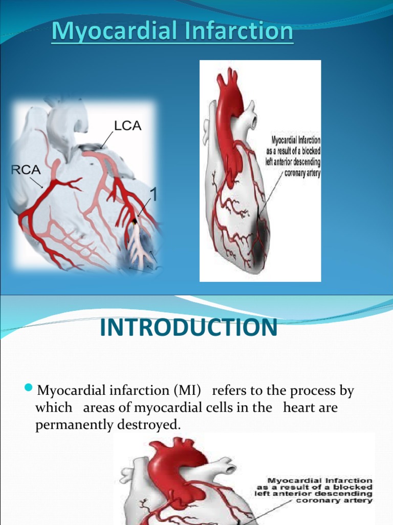 MI | PDF | Myocardial Infarction | Atherosclerosis