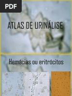 Atlas de Urinálise e Hematúria | PDF | Glóbulo branco | Infecção do ...