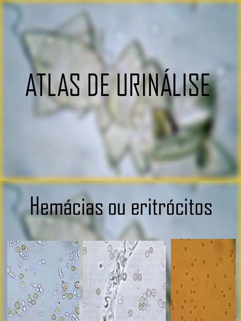 Atlas de Urinalise | PDF