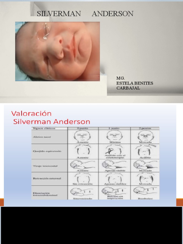 Silverman Anderson | PDF | Neumonía | Pulmón