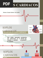 Índices Sokolow y Lewis en EKG | PDF