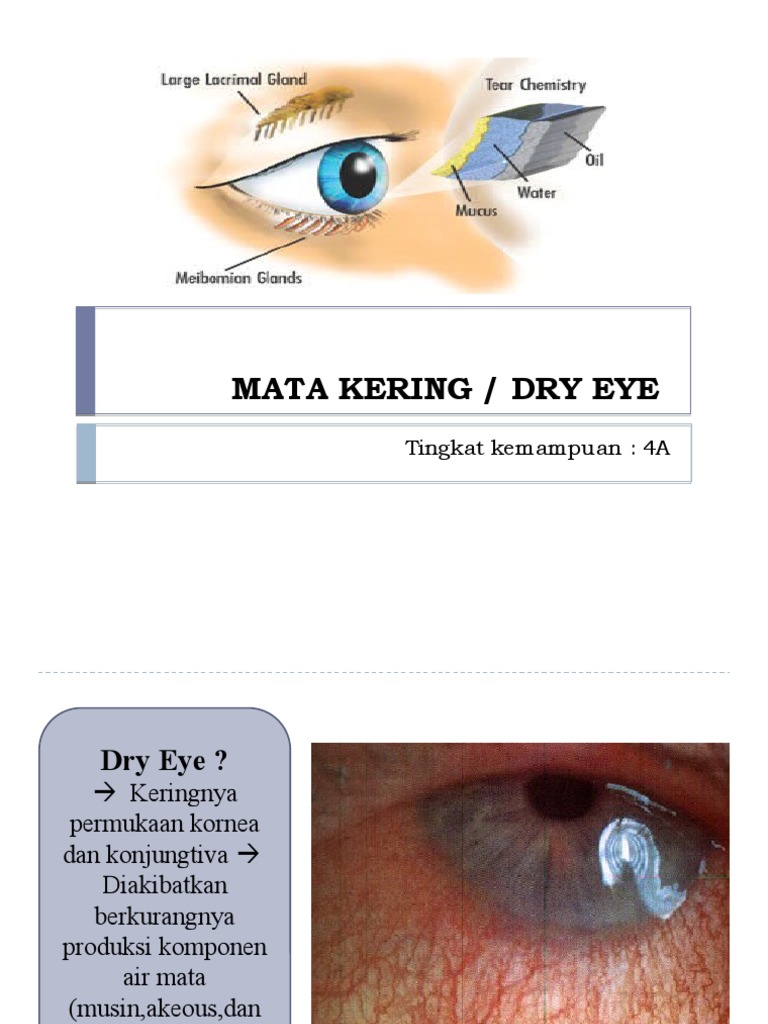 PPT DRY Eye | PDF
