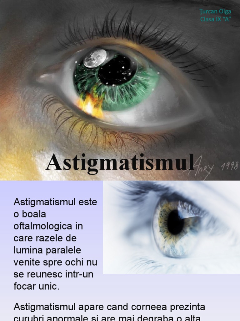 Astigmatismul | PDF
